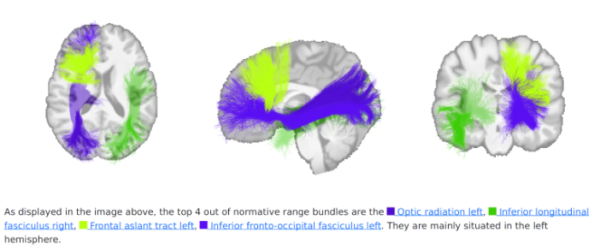 Spin Tech MRI TBI Protocol: Advanced Imaging for Traumatic Brain Injury ...